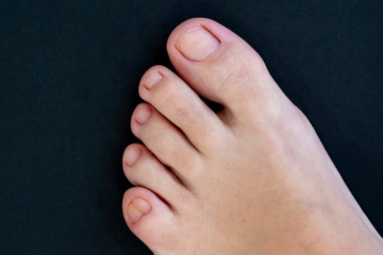 Toenail Stopped Growing? Here's What To Do - Luxe Luminous